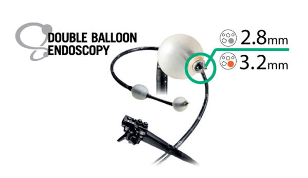 Double Balloon – Global Technology